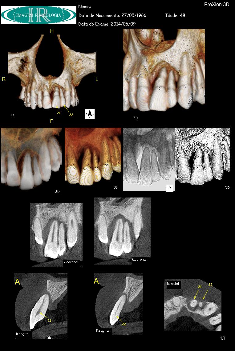 TCFC x AVALIAÇÃO PERIODONTAL :: NelmaRadiologia